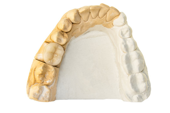 รูปภาพCermets – เลือกดูภาพถ่ายสต็อก เวกเตอร์ และวิดีโอ333 | Adobe Stock