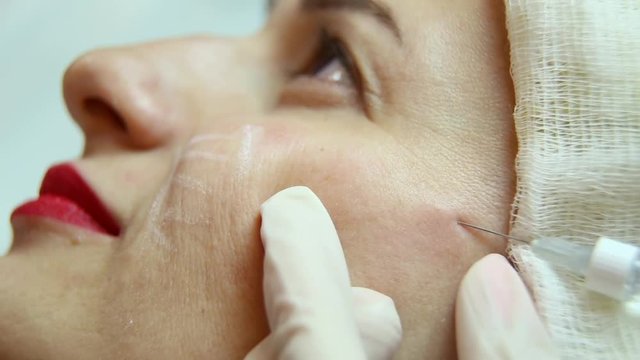 Intradermal Images – Parcourir 1,784 le catalogue de photos, vecteurs ...