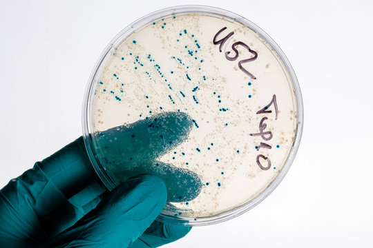 Microbal Bilder – Durchsuchen 81 Archivfotos, Vektorgrafiken und Videos ...