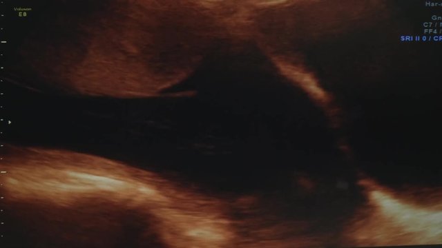 「Sonograph」の画像 - 201 件の Stock 写真、ベクターおよびビデオ | Adobe Stock