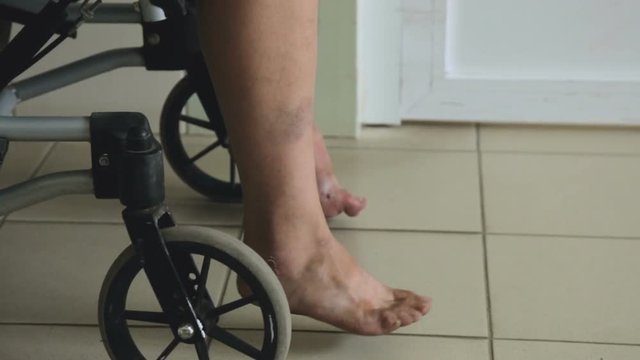 รูปภาพTraumatology – เลือกดูภาพถ่ายสต็อก เวกเตอร์ และวิดีโอ21,877 ...