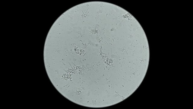 Proteus Vulgaris Under Microscope