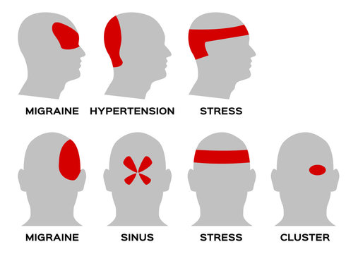 1,568 BEST Types Of Headaches IMAGES, STOCK PHOTOS & VECTORS | Adobe Stock 1,568 BEST Types Of Headaches IMAGES, STOCK PHOTOS & VECTORS | Adobe Stock