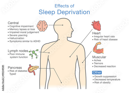 "Diagram of Effects of Sleep deprivation. Illustration about disease ...