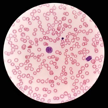 Nrbc Images – Browse 94 Stock Photos, Vectors, and Video | Adobe Stock