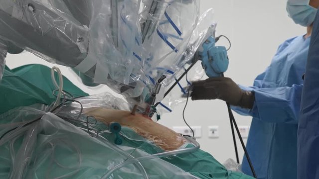 Appendectomy Images – Browse 970 Stock Photos, Vectors, and Video ...