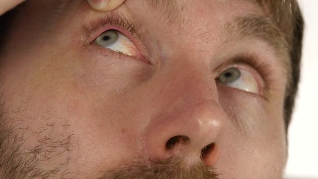 Meibom Bilder – Durchsuchen 32 Archivfotos, Vektorgrafiken und Videos ...