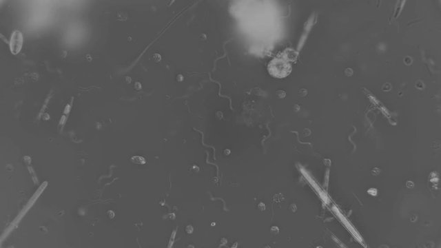 Typhus Images – Browse 1,657 Stock Photos, Vectors, and Video | Adobe Stock