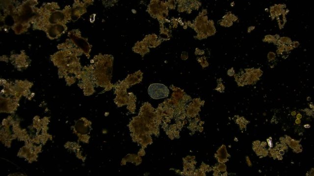 Ciliat Bilder – Durchsuchen 2,551 Archivfotos, Vektorgrafiken und ...