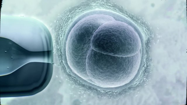 Icsi Images – Browse 439 Stock Photos, Vectors, and Video | Adobe Stock