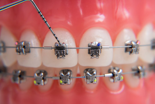 Zahnaufbau Bilder – Durchsuchen 8,025 Archivfotos, Vektorgrafiken und ...