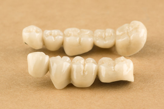 Cermet Images – Browse 182 Stock Photos, Vectors, and Video | Adobe Stock