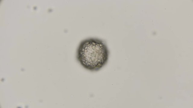 Difflugia Imagens – Procure 45 fotos, vetores e vídeos | Adobe Stock