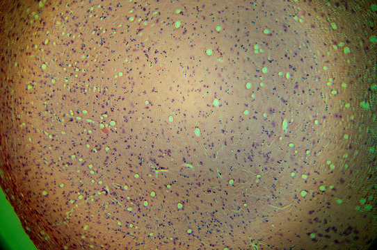 รูปภาพInfusoria – เลือกดูภาพถ่ายสต็อก เวกเตอร์ และวิดีโอ1,166 | Adobe Stock