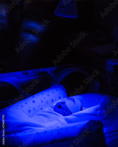 Preterm Baby Under Light
