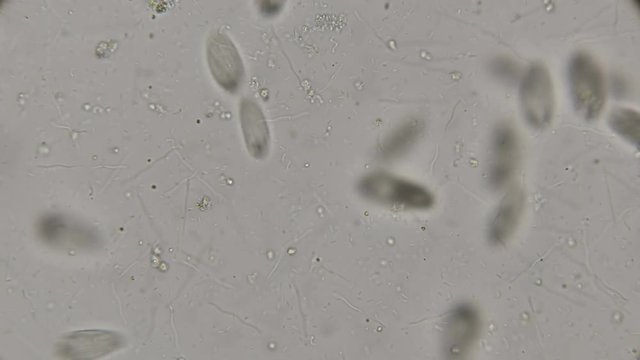 Simonsiella Imagens – Procure 14 fotos, vetores e vídeos | Adobe Stock