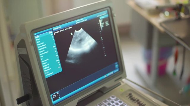 Sonograph Bilder – Durchsuchen 197 Archivfotos, Vektorgrafiken und ...