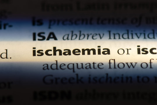 Ischaemia Images – Browse 2,960 Stock Photos, Vectors, and Video ...