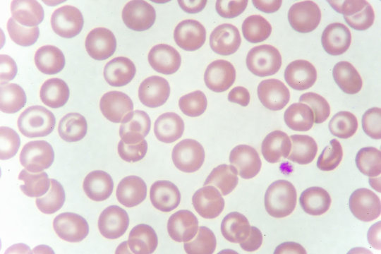 รูปภาพAbnormal – เลือกดูภาพถ่ายสต็อก เวกเตอร์ และวิดีโอ31,185 | Adobe Stock