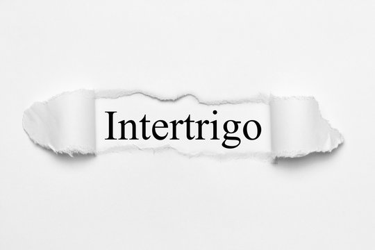Intertrigo Images – Browse 57 Stock Photos, Vectors, and Video | Adobe ...