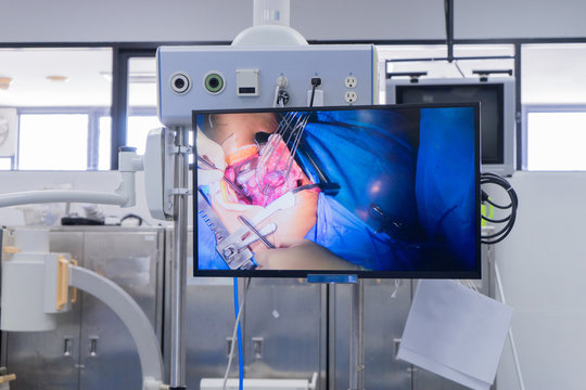 รูปภาพCabg – เลือกดูภาพถ่ายสต็อก เวกเตอร์ และวิดีโอ689 | Adobe Stock