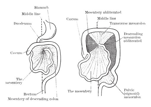 Small Intestine Mesentery