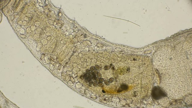 "Intestinal Worms" Images – Browse 306 Stock Photos, Vectors, and Video ...