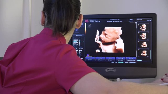 Ecography Images – Browse 1,065 Stock Photos, Vectors, and Video ...