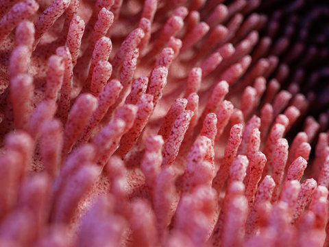 Damaged Villi Bilder – Durchsuchen 180 Archivfotos, Vektorgrafiken und ...