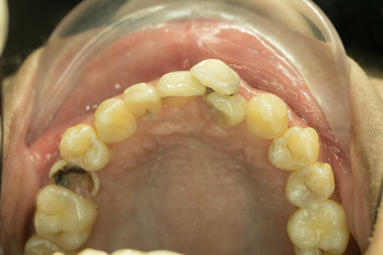 Malposition Images – Browse 210 Stock Photos, Vectors, and Video ...