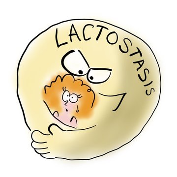 Lactostasis Images – Browse 71 Stock Photos, Vectors, and Video | Adobe ...