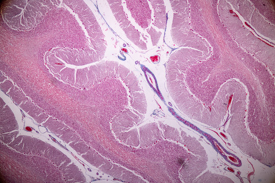 รูปภาพNeurous – เลือกดูภาพถ่ายสต็อก เวกเตอร์ และวิดีโอ75 | Adobe Stock