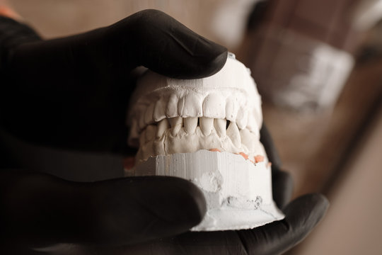 Orthodontal Bilder – Durchsuchen 1,462 Archivfotos, Vektorgrafiken und ...