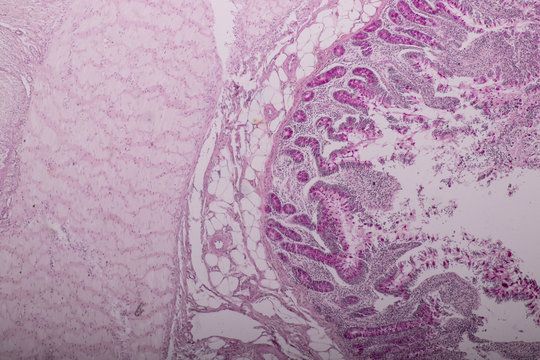 รูปภาพEnteritis – เลือกดูภาพถ่ายสต็อก เวกเตอร์ และวิดีโอ954 | Adobe Stock