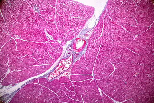 Pancreatic Duct Slide