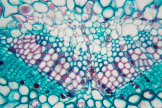 Microsection Bilder – Durchsuchen 46 Archivfotos, Vektorgrafiken und ...