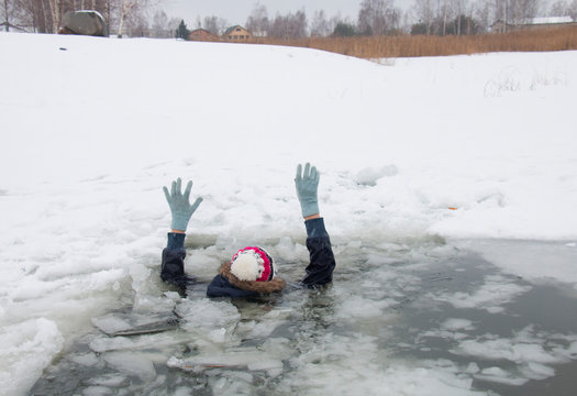 รูปภาพFrostbite – เลือกดูภาพถ่ายสต็อก เวกเตอร์ และวิดีโอ7,061 | Adobe Stock