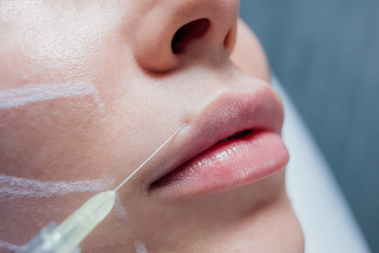 รูปภาพInjectables – เลือกดูภาพถ่ายสต็อก เวกเตอร์ และวิดีโอ6,634,968 ...