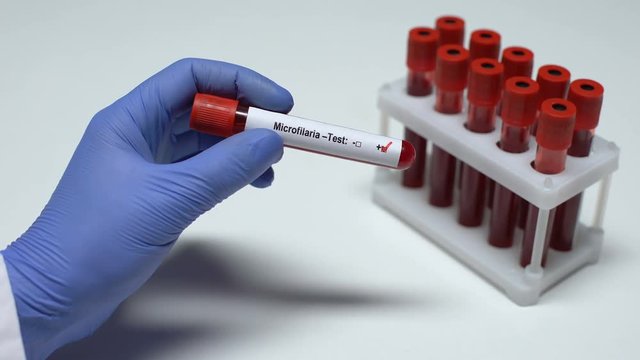 รูปภาพMicrofilaria – เลือกดูภาพถ่ายสต็อก เวกเตอร์ และวิดีโอ140 | Adobe ...