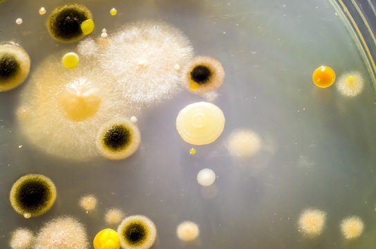 รูปภาพMicrococcus – เลือกดูภาพถ่ายสต็อก เวกเตอร์ และวิดีโอ793 | Adobe Stock
