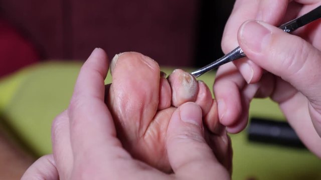 รูปภาพClavus – เลือกดูภาพถ่ายสต็อก เวกเตอร์ และวิดีโอ100,213 | Adobe Stock