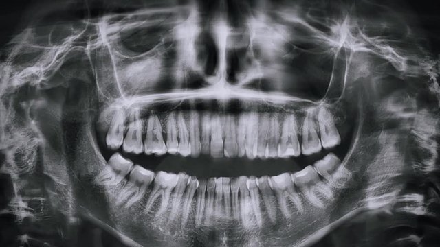 Pantomogram bilder – Bläddra bland 50 stockfoton, vektorer och videor ...