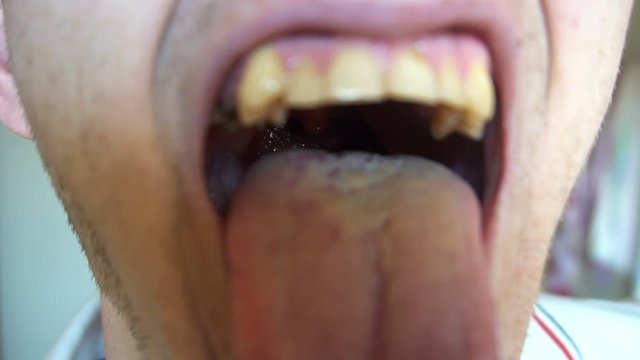 Uvula Images – Browse 2,344 Stock Photos, Vectors, and Video | Adobe Stock