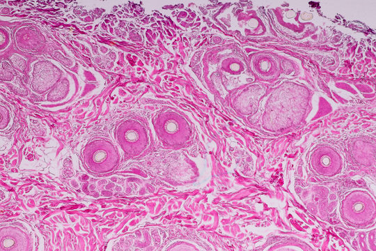 รูปภาพ"Arrector Pili Muscle" – เลือกดูภาพถ่ายสต็อก เวกเตอร์ และวิดีโอ ...