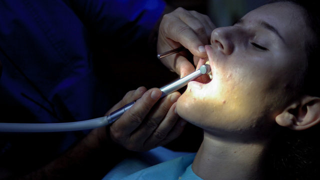 Apicoectomy Images – Browse 14 Stock Photos, Vectors, and Video | Adobe ...