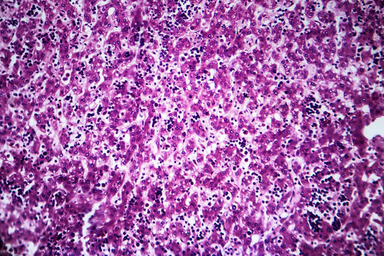 รูปภาพHepadnavirus – เลือกดูภาพถ่ายสต็อก เวกเตอร์ และวิดีโอ359 | Adobe ...