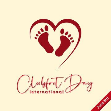 Clubfoot Images – Browse 1,743 Stock Photos, Vectors, and Video | Adobe ...
