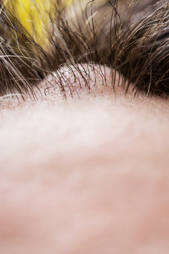 Atherom Bilder – Durchsuchen 2,692 Archivfotos, Vektorgrafiken und ...