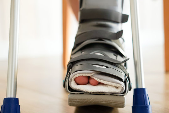 Beinbruch Images – Browse 26 Stock Photos, Vectors, and Video | Adobe Stock