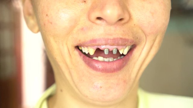 Toothless Woman Images – Browse 3,294 Stock Photos, Vectors, and Video ...